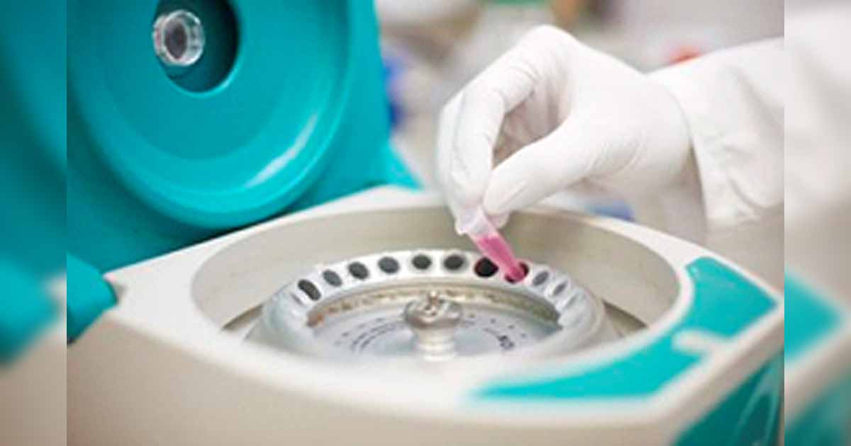Τι είναι οι οφθαλμικές σταγόνες αυτόλογου ορού και που χρησιμοποιούνται ...